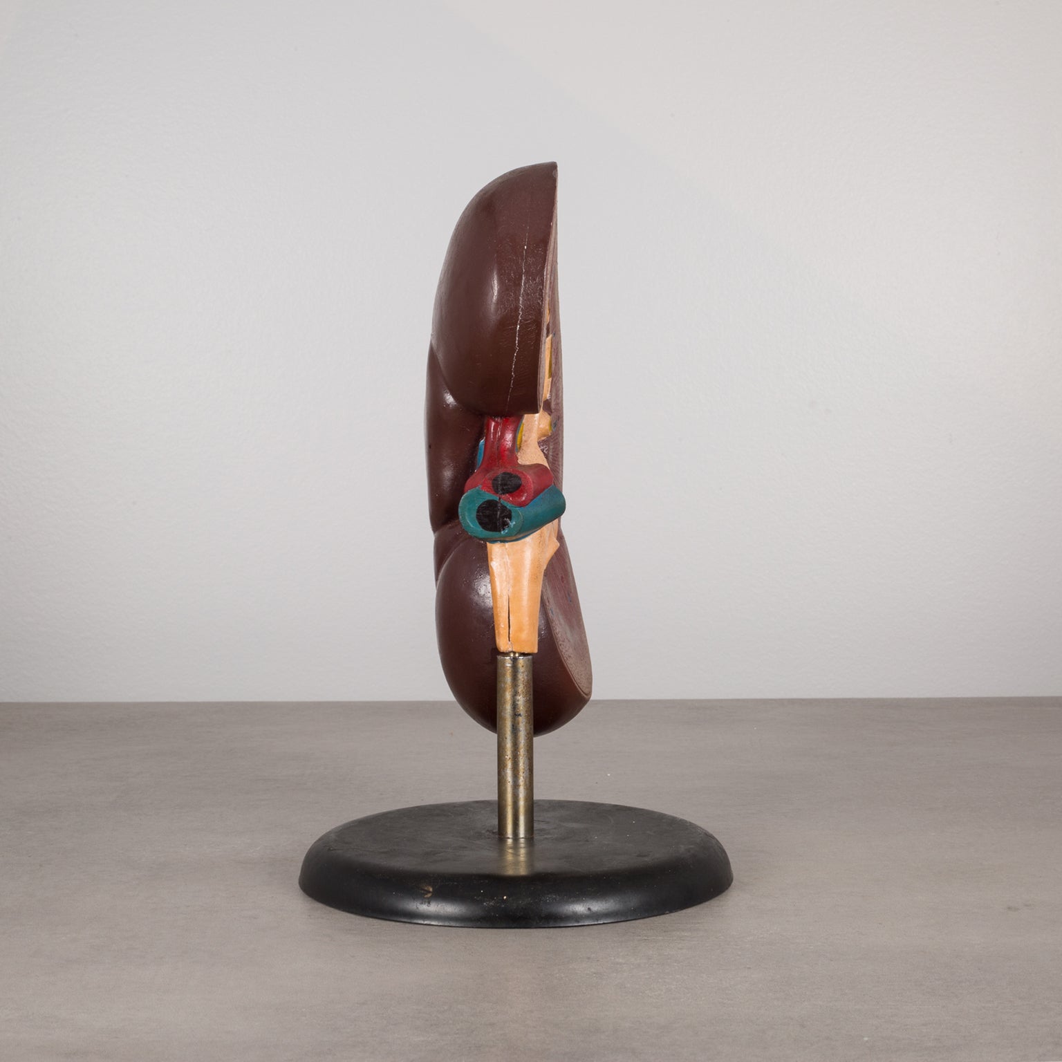 Professional Medical Teaching Display of Human Kidney c.1970 – S16 Home