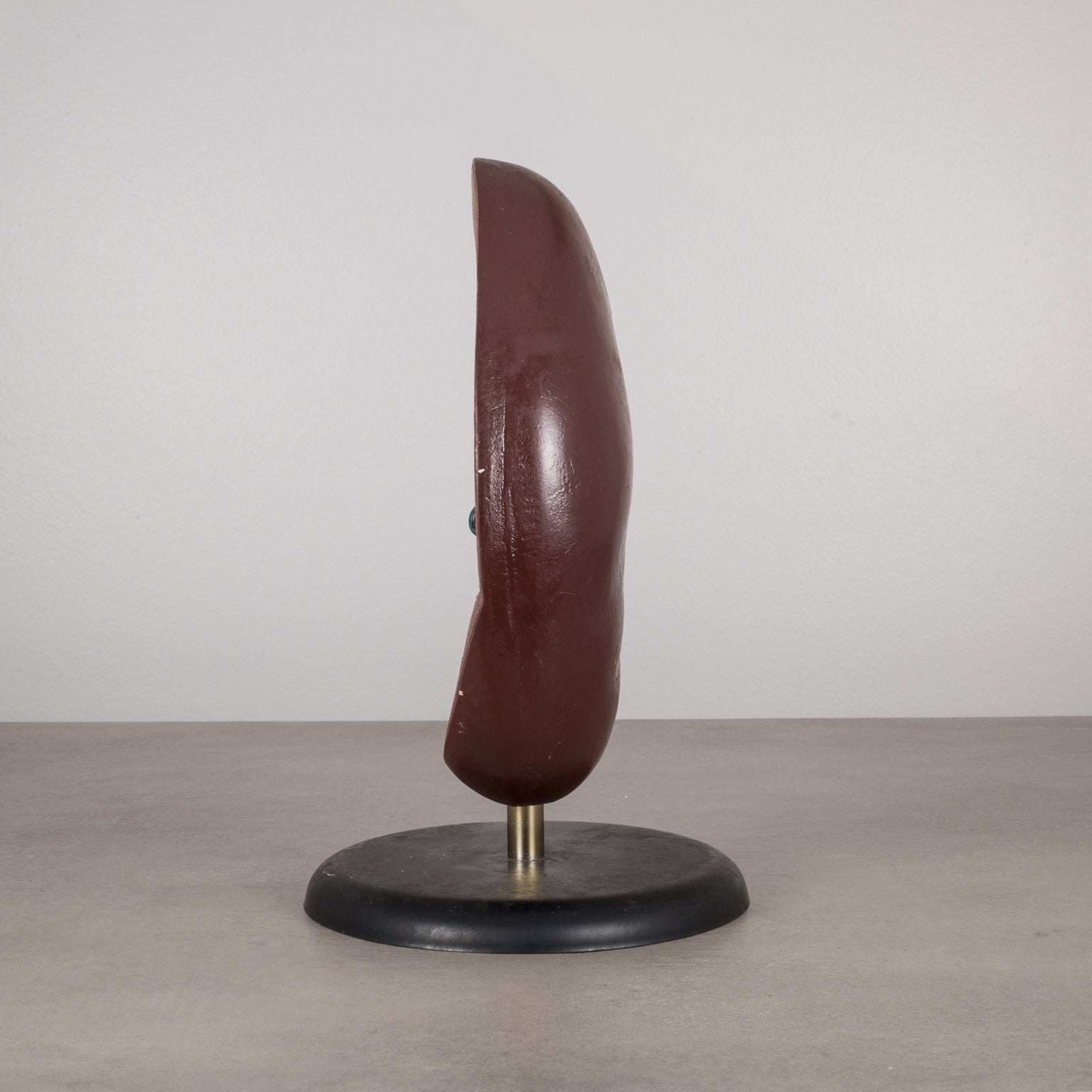 Professional Medical Teaching Display of Human Kidney c.1970 – S16 Home